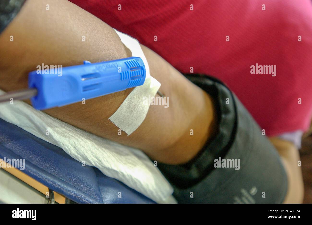 A cannula inserted into the arm of a blood donor Stock Photo - Alamy