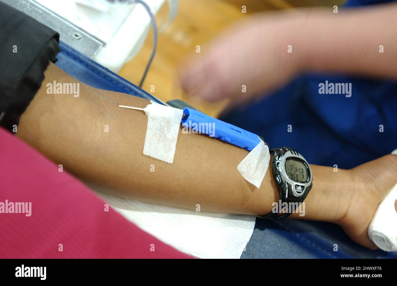 A cannula inserted into the arm of a blood donor Stock Photo - Alamy