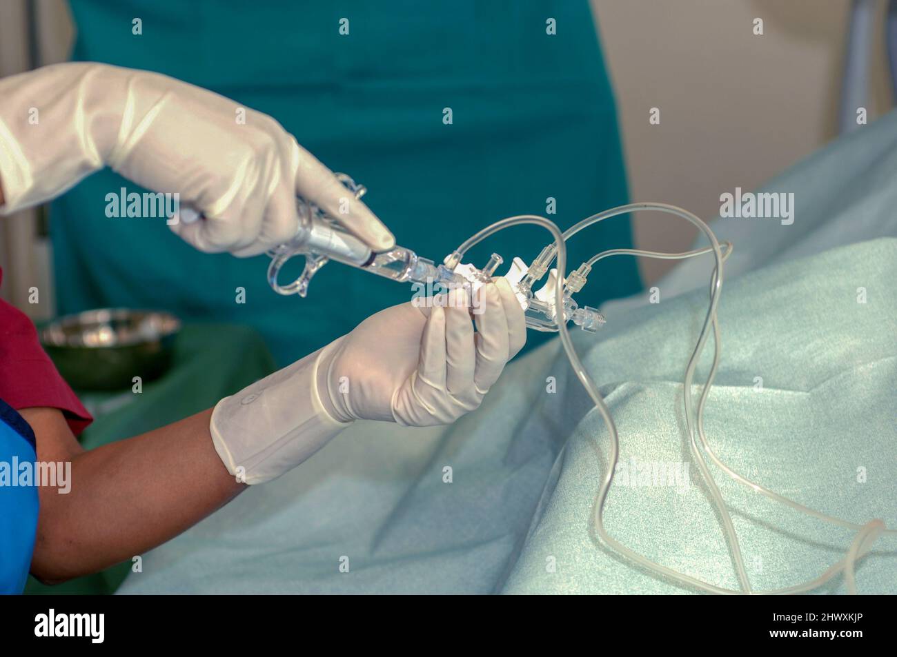 The control syringe and three-way manifold that is used during trans ...