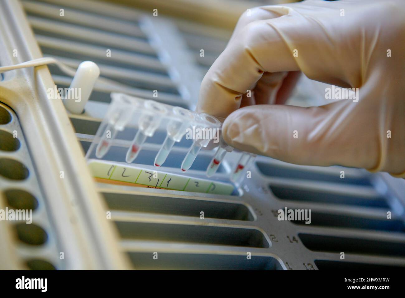 Analysis of blood samples Stock Photo - Alamy