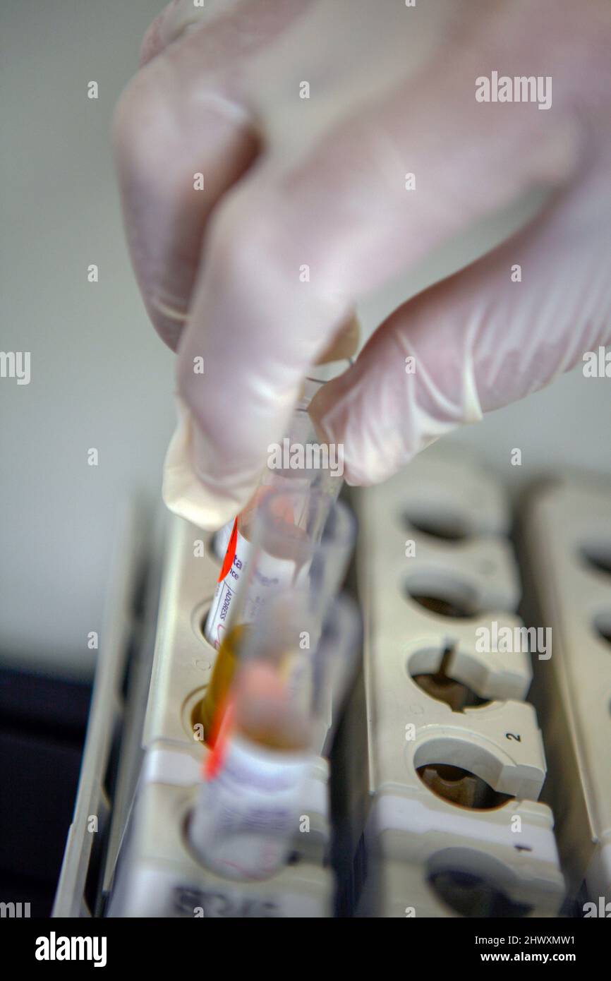 Preparation of glass vials in rack holder Stock Photo - Alamy