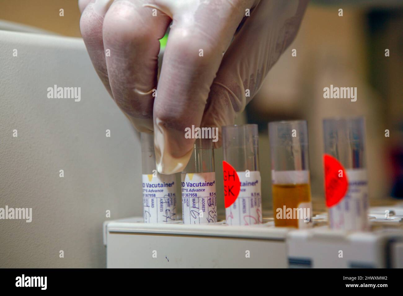 Preparation of glass vials in rack holder Stock Photo - Alamy Preparation of glass vials in rack holder Stock Photo - Alamy
