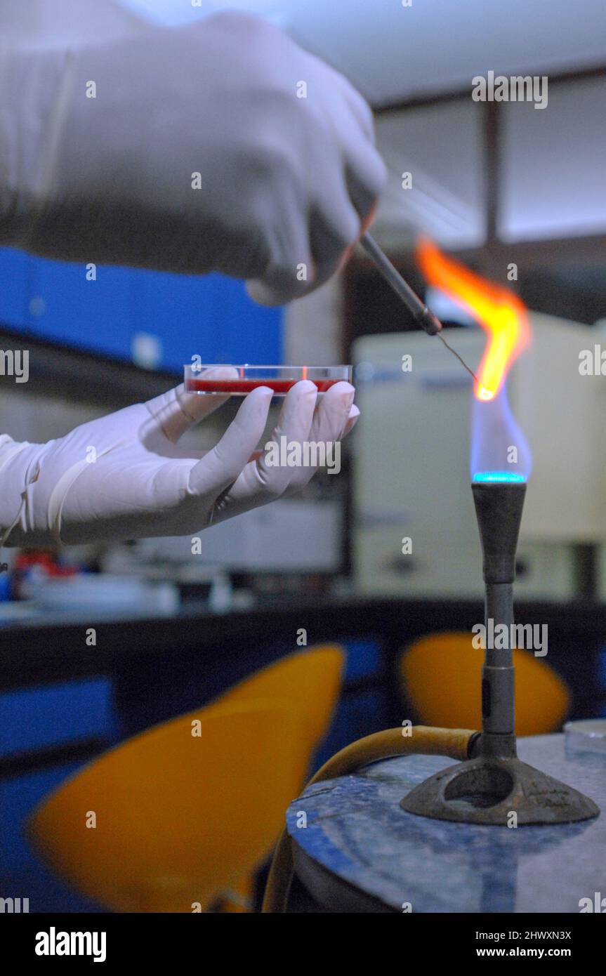 Blood agar plate hi-res stock photography and images - Alamy
