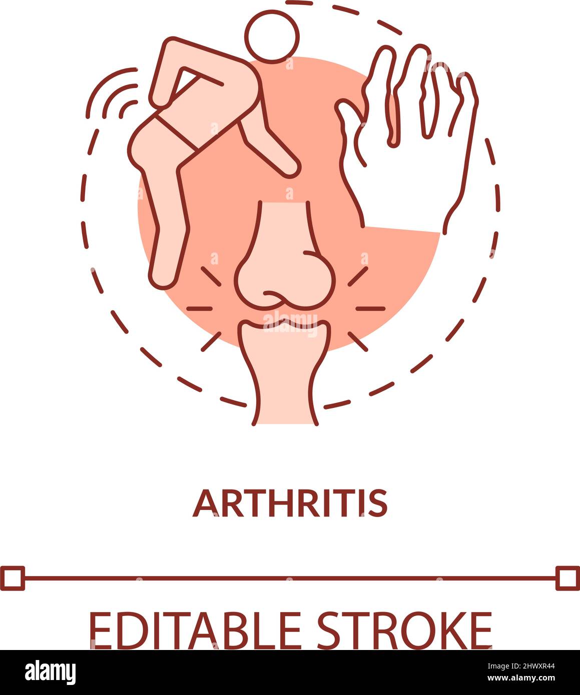 Knee osteoarthritis drawing Stock Vector Images - Alamy
