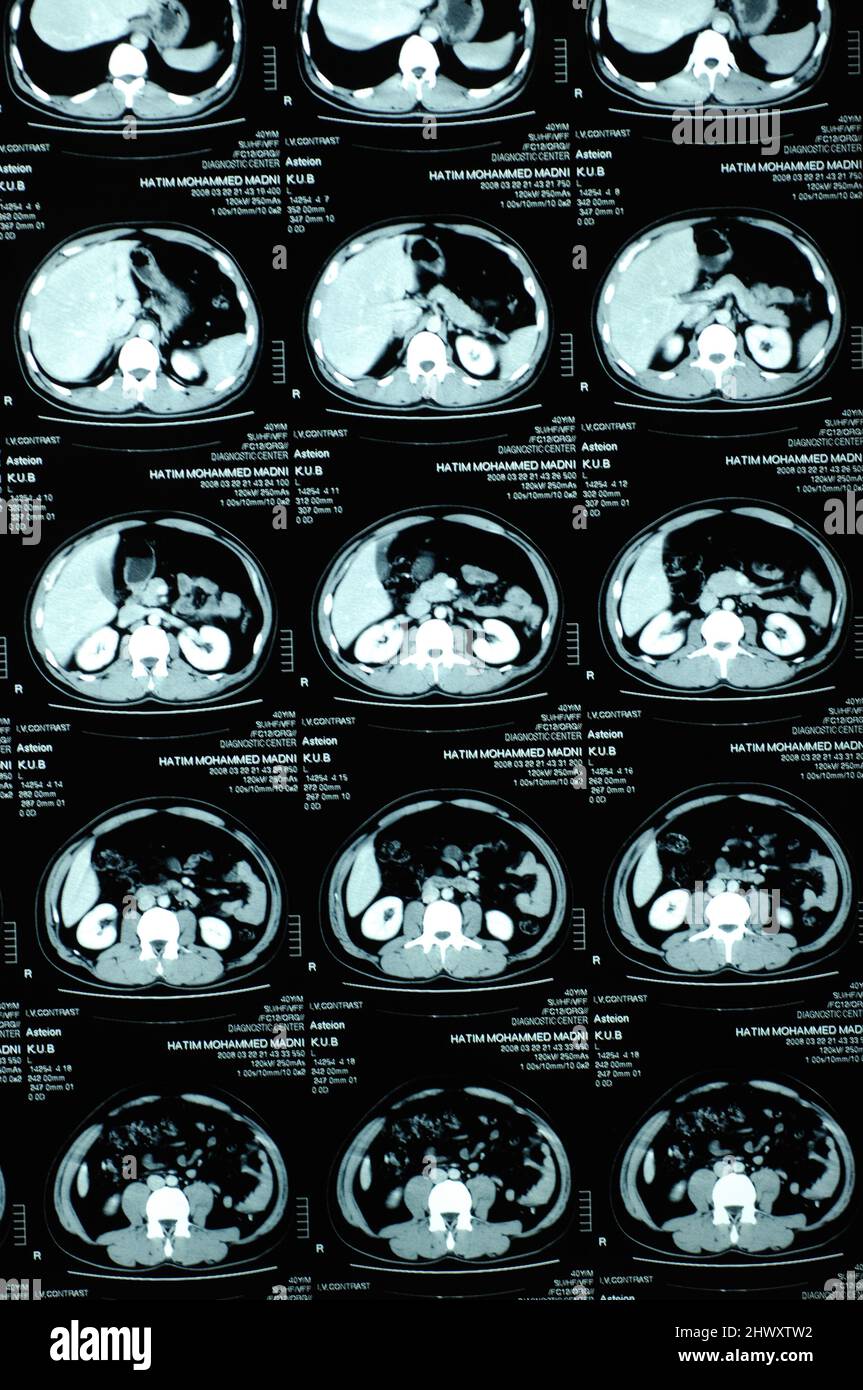 A scan of a woman's reproductive system Stock Photo - Alamy