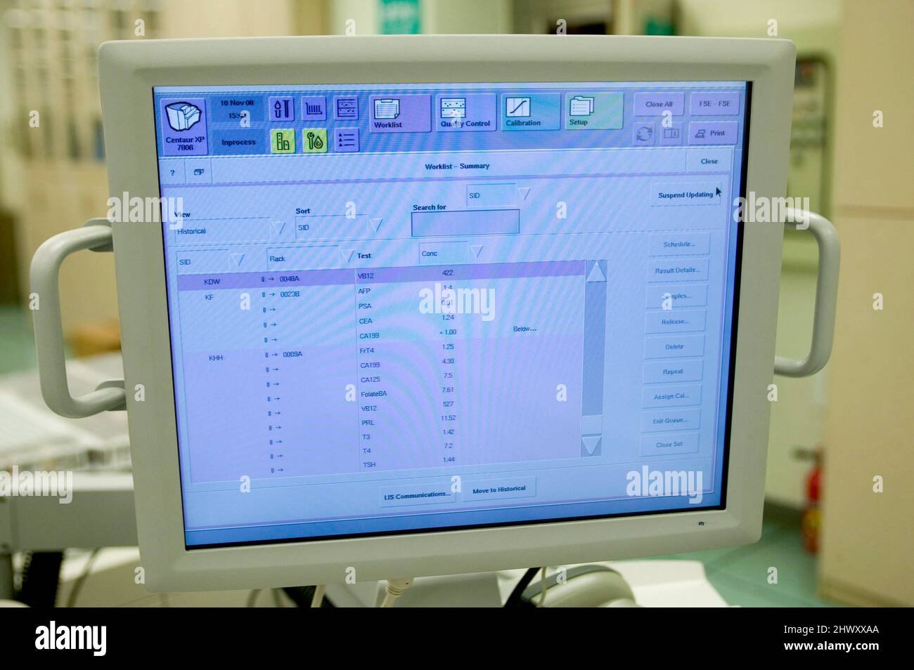 A monitor used in the testing and analysis of blood samples Stock Photo ...