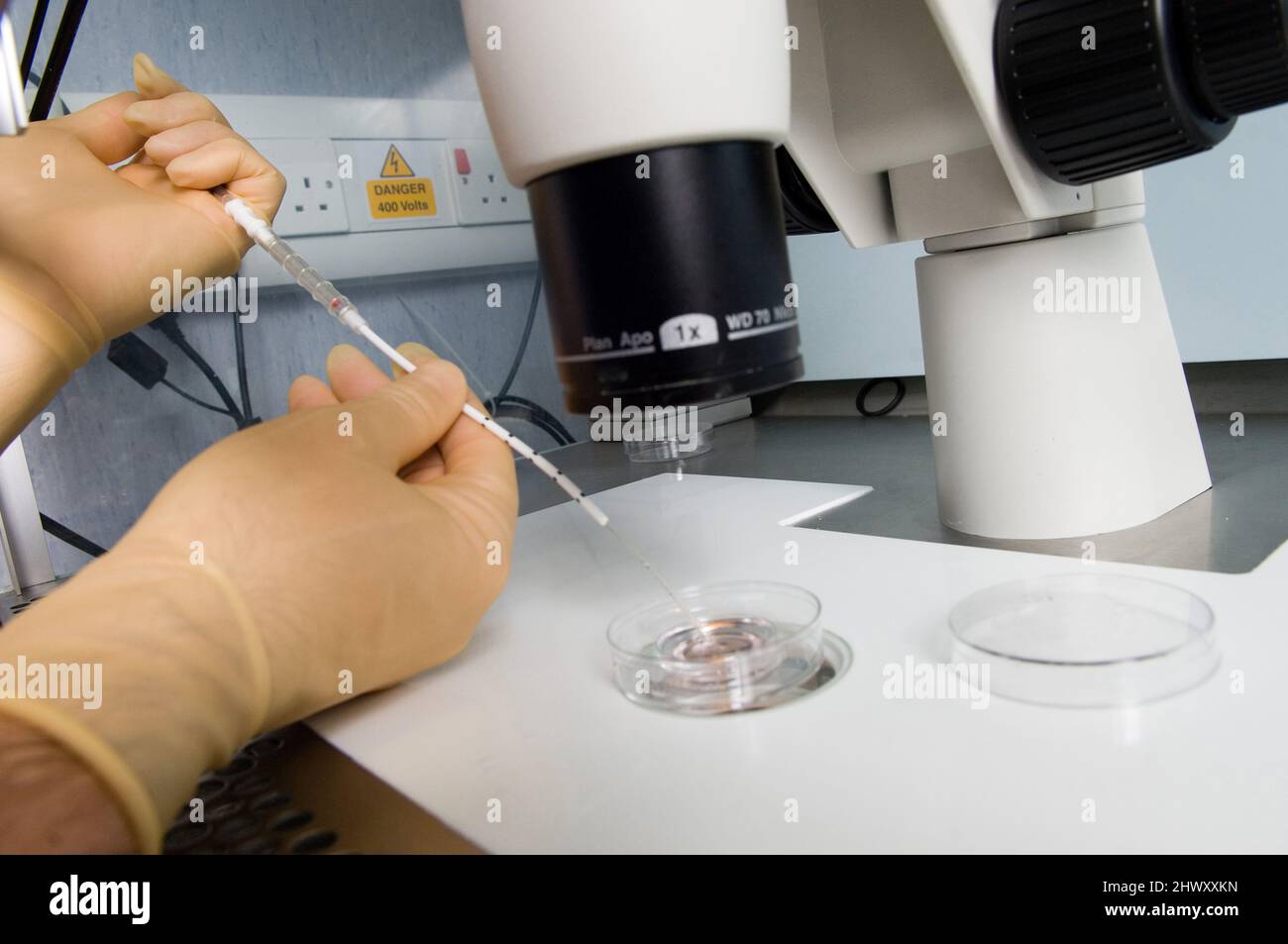 Before implantation and during hormone therapy CT scans are performed ...