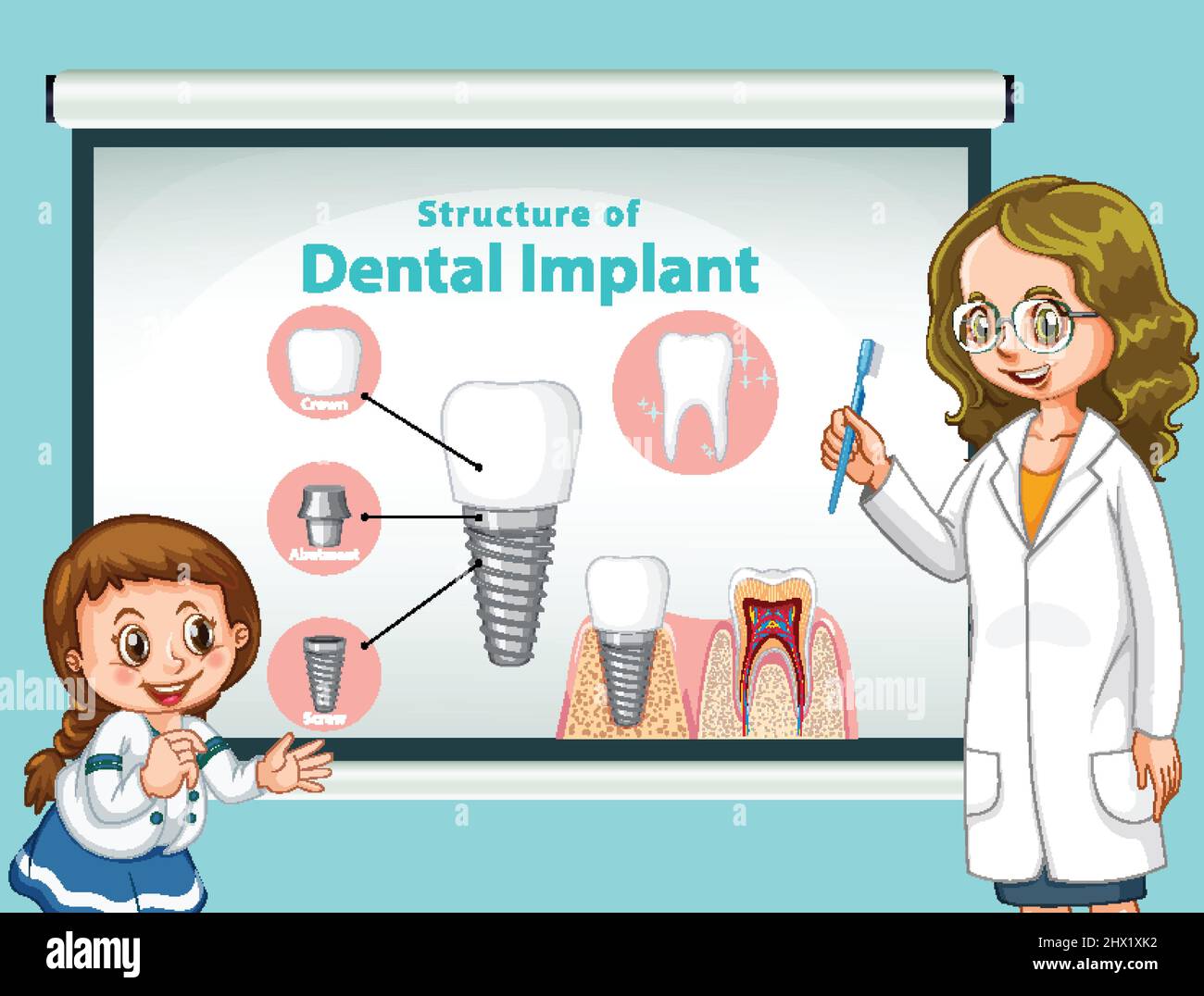 Infographic of human in structure of the dental implant illustration ...