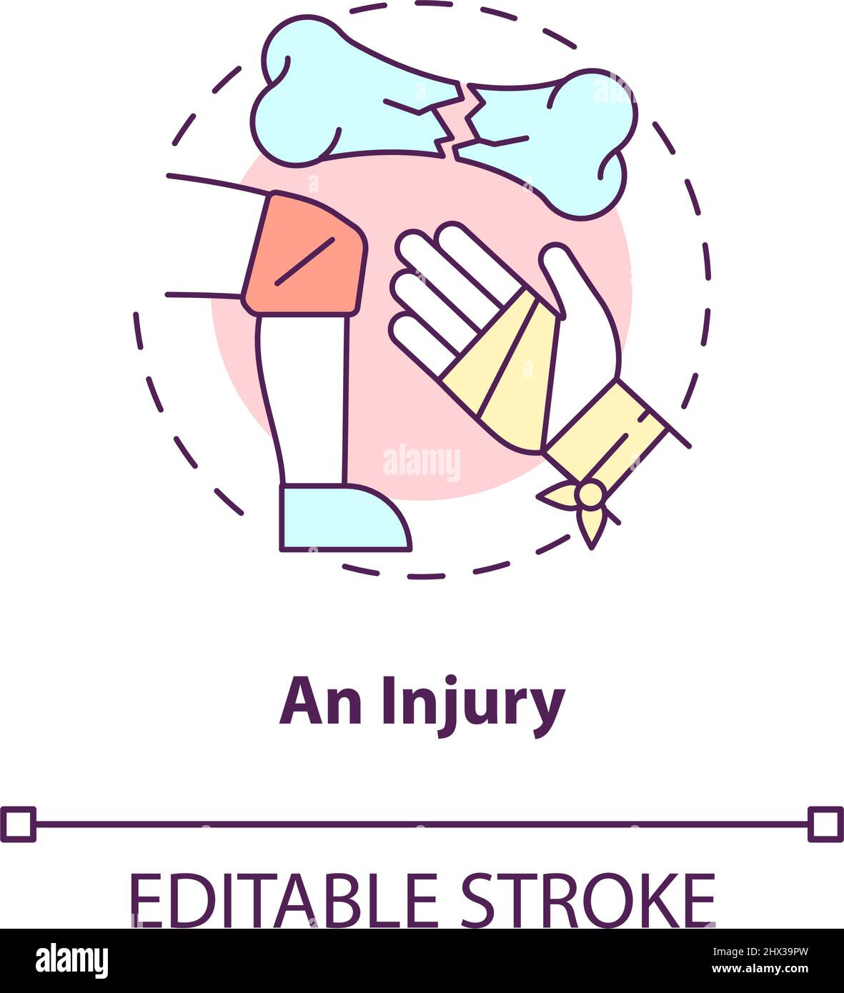 Complex bone fracture Stock Vector Images - Alamy