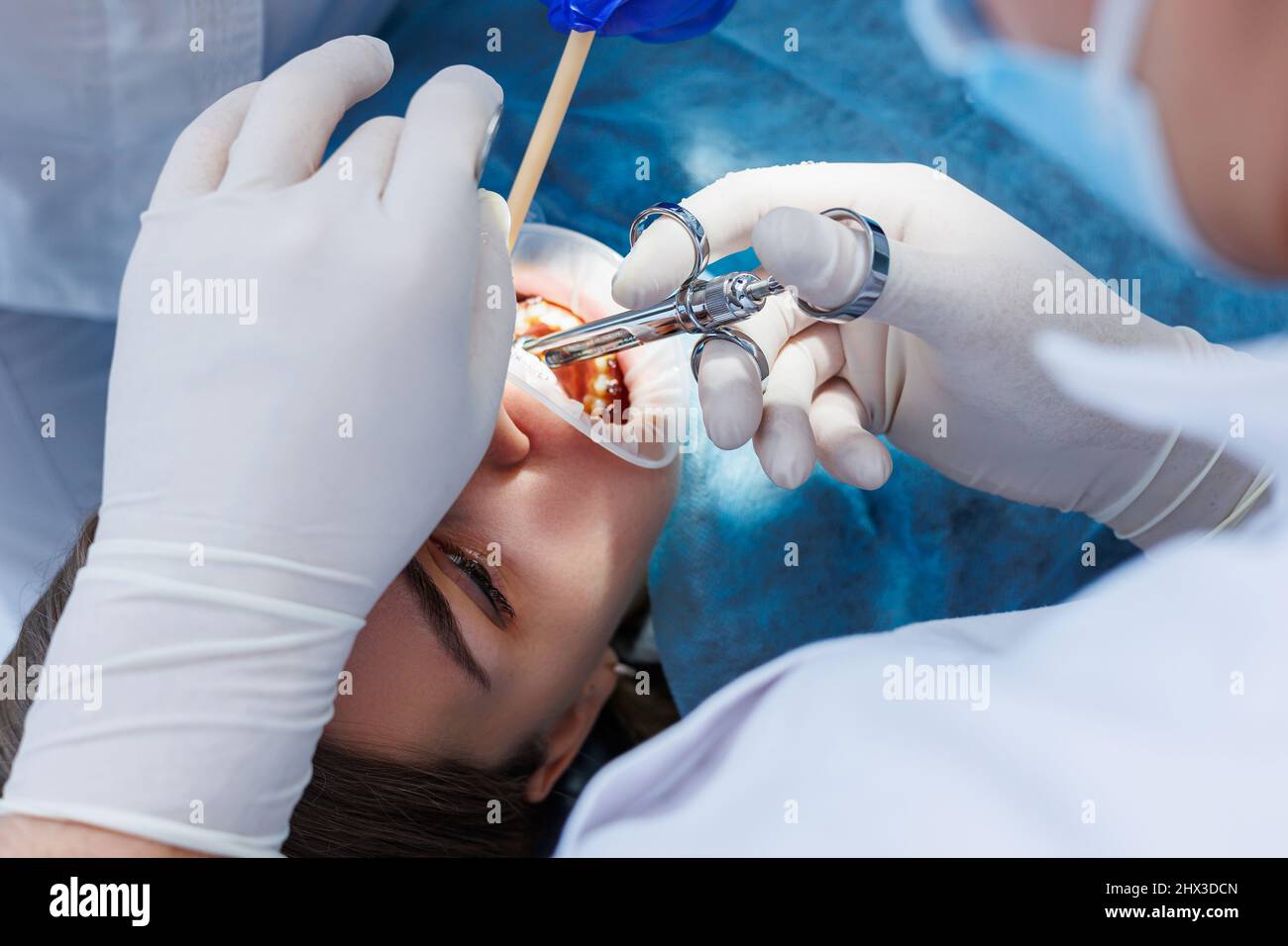 The dentist examines the patient's teeth using dental equipment. Modern ...