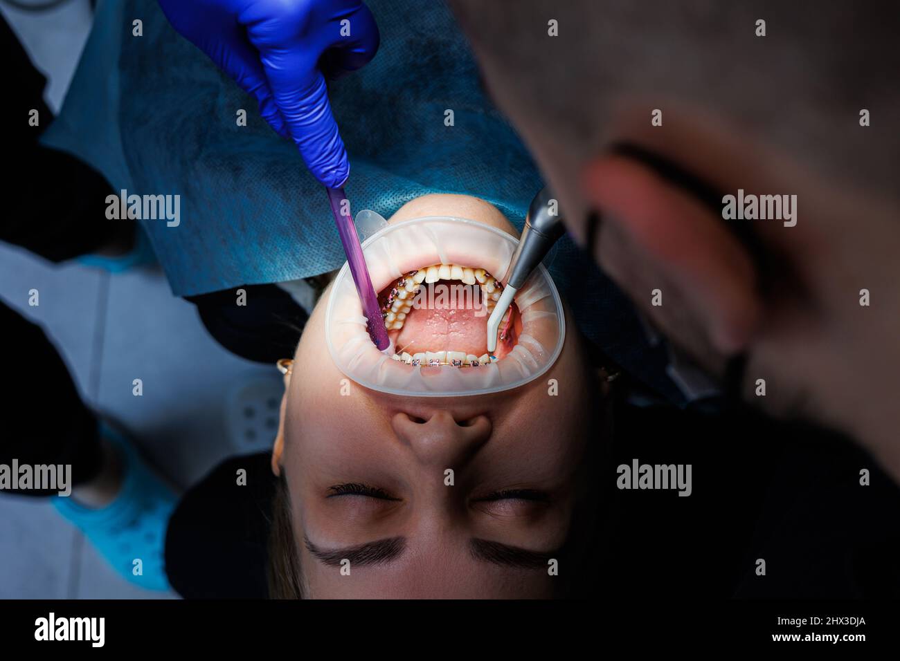 Nose alignment hi-res stock photography and images - Alamy