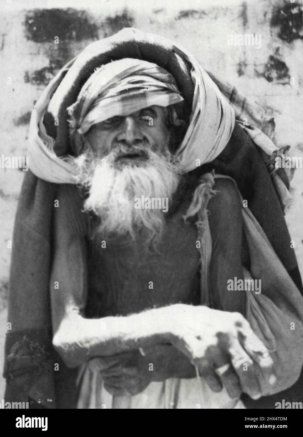 Starvation In The Elderly