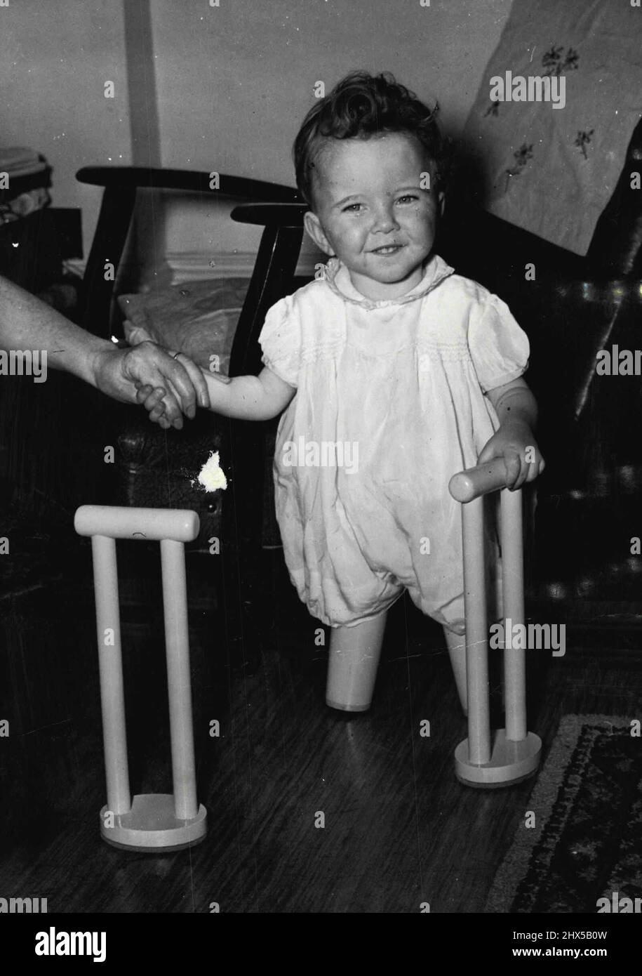 Britain's Wonder Baby. Two-year-old Glyn Evans, who was born without ...