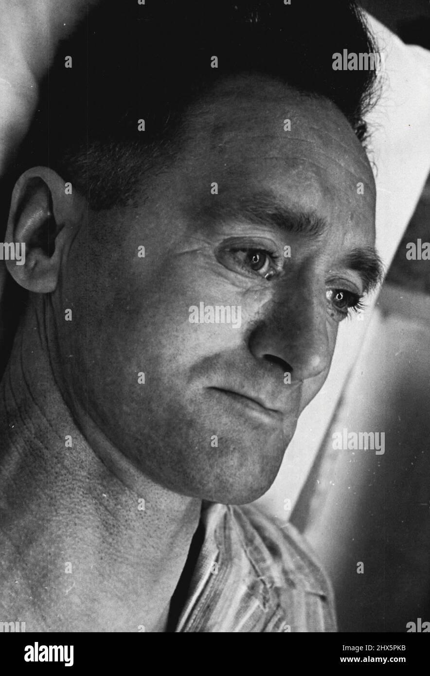 Plastic Surgery In Britain -- This show another view of the defect and ...