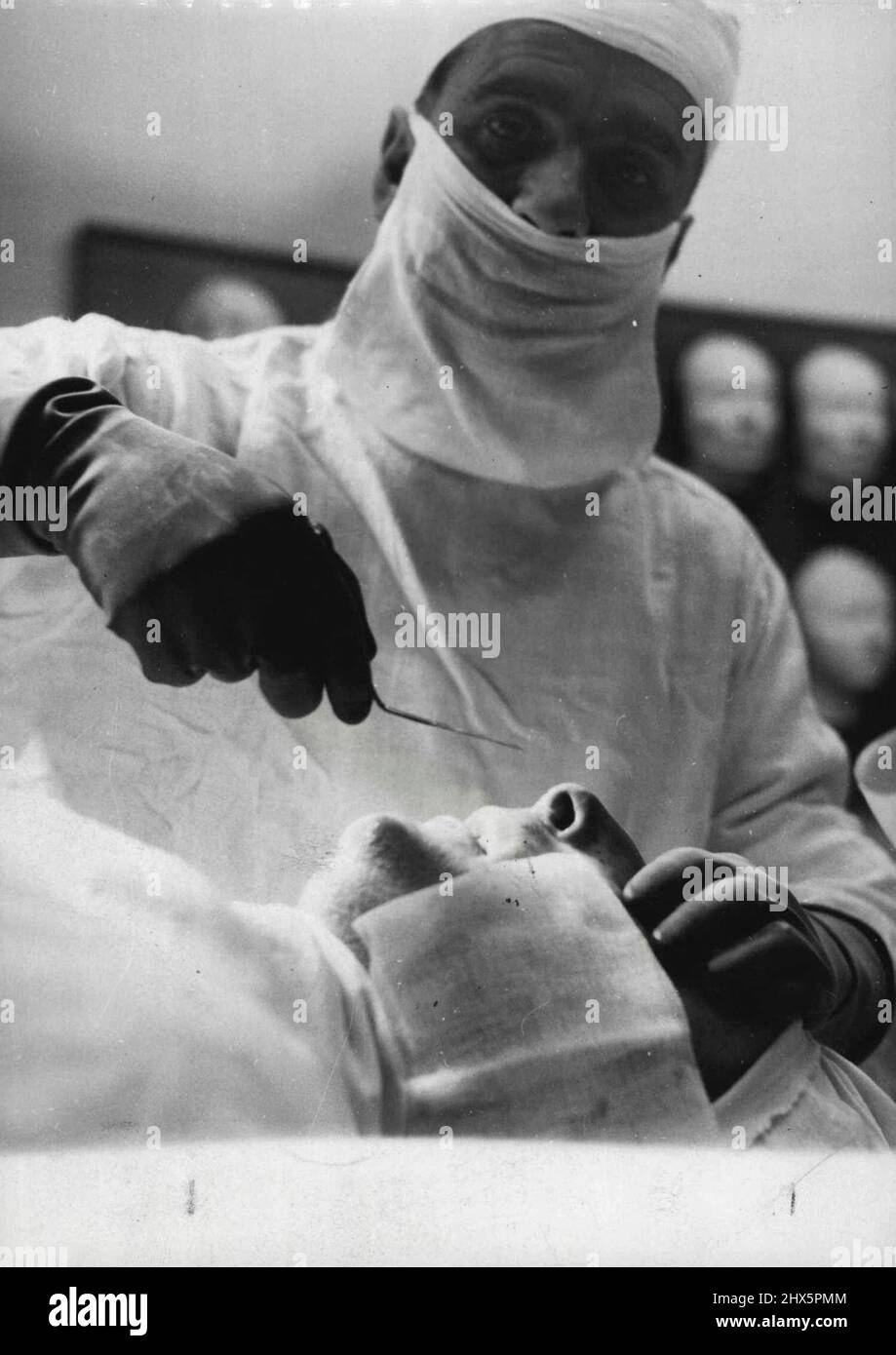 Patient with a nose he thinks is too prominent lies quietly under local ...