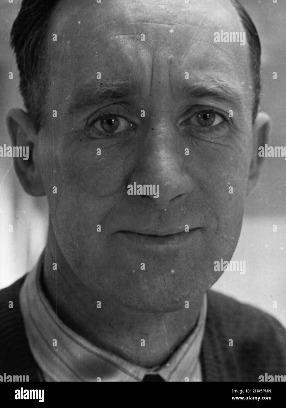 Plastic Surgery In Britain -- One week later. September 03, 1951 ...