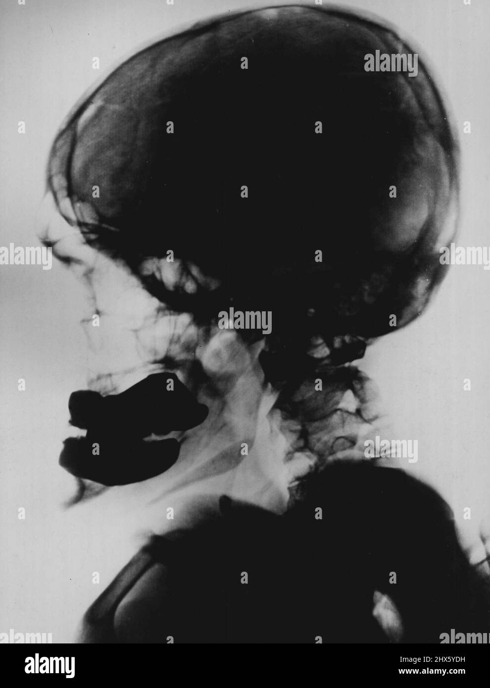 Neck twisted Black and White Stock Photos & Images - Alamy