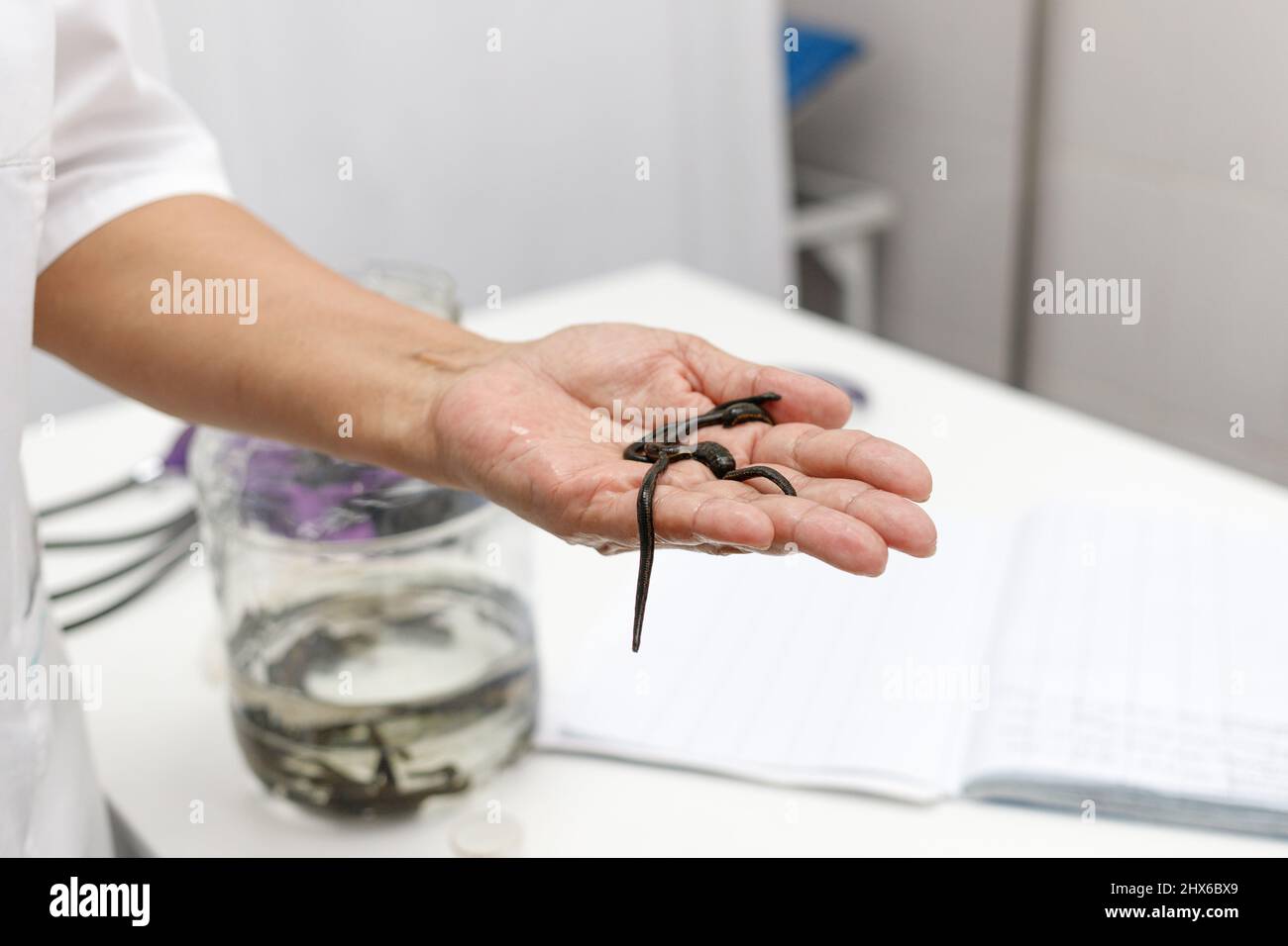 Medical leeches in the hand of a traditional medicine clinic doctor ...