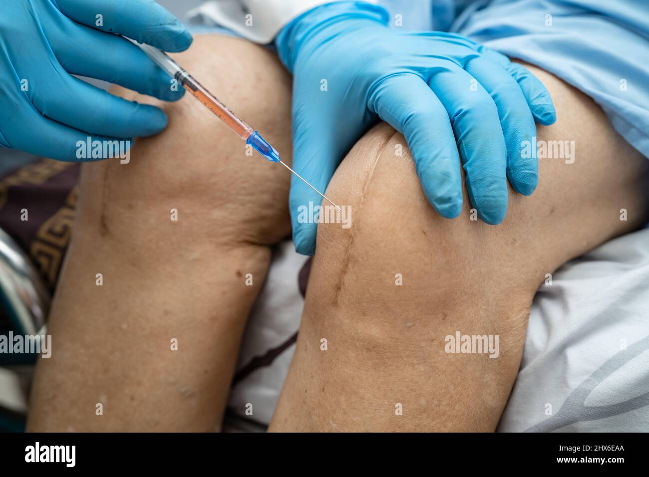 Asian doctor inject Hyaluronic acid platelet rich plasma into the knee of senior woman to walk ...