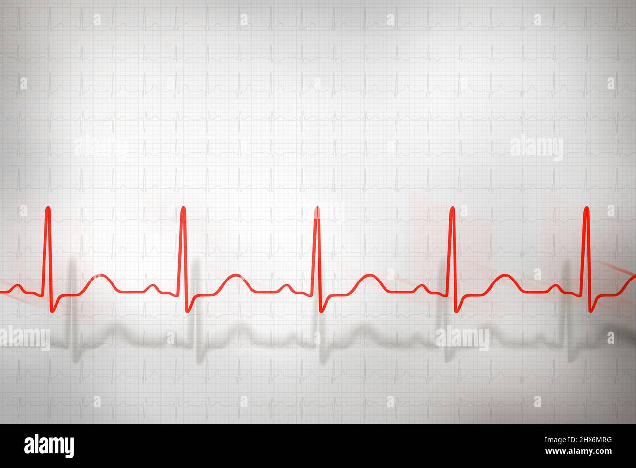 Normal ecg hi-res stock photography and images - Alamy