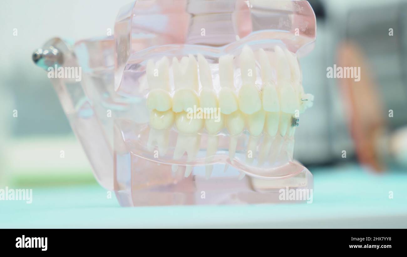 Close-up of denture jaw. Media. Denture of jaws with teeth with ...