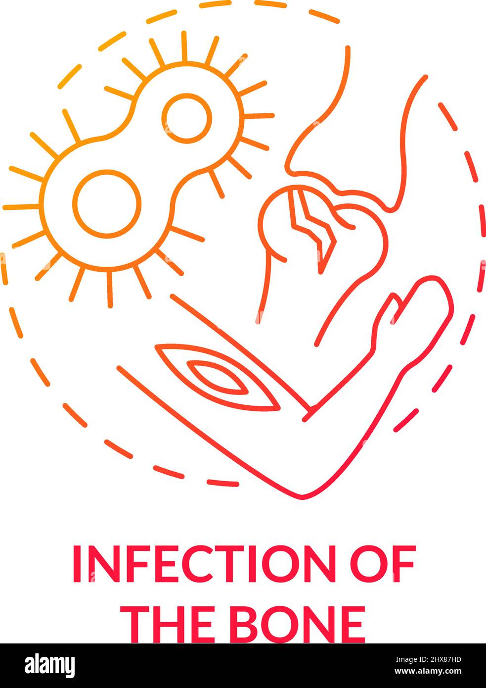 Infection of bone red gradient concept icon Stock Vector Image & Art ...