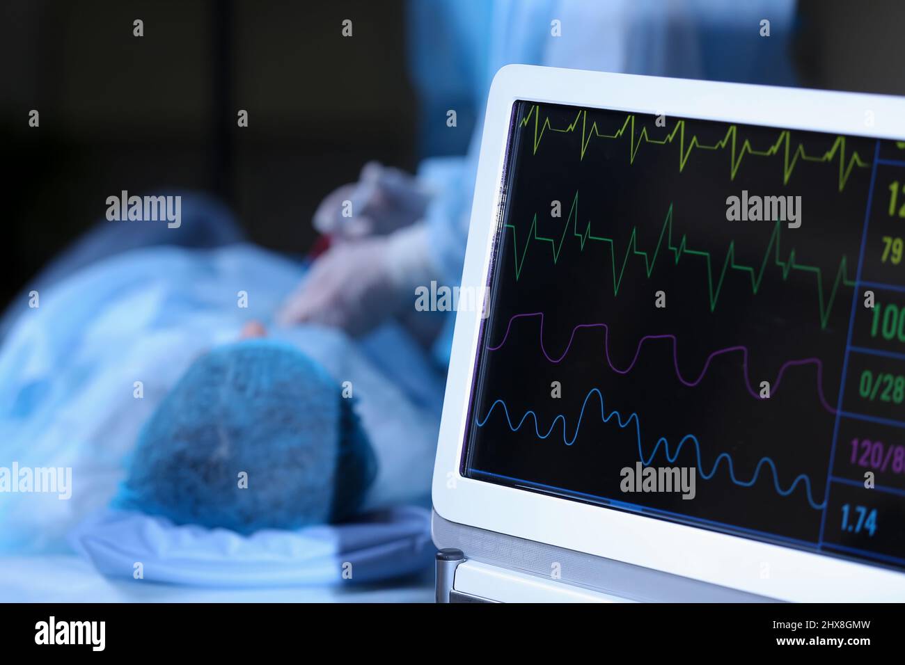 Modern heart rate monitor in operating room Stock Photo - Alamy