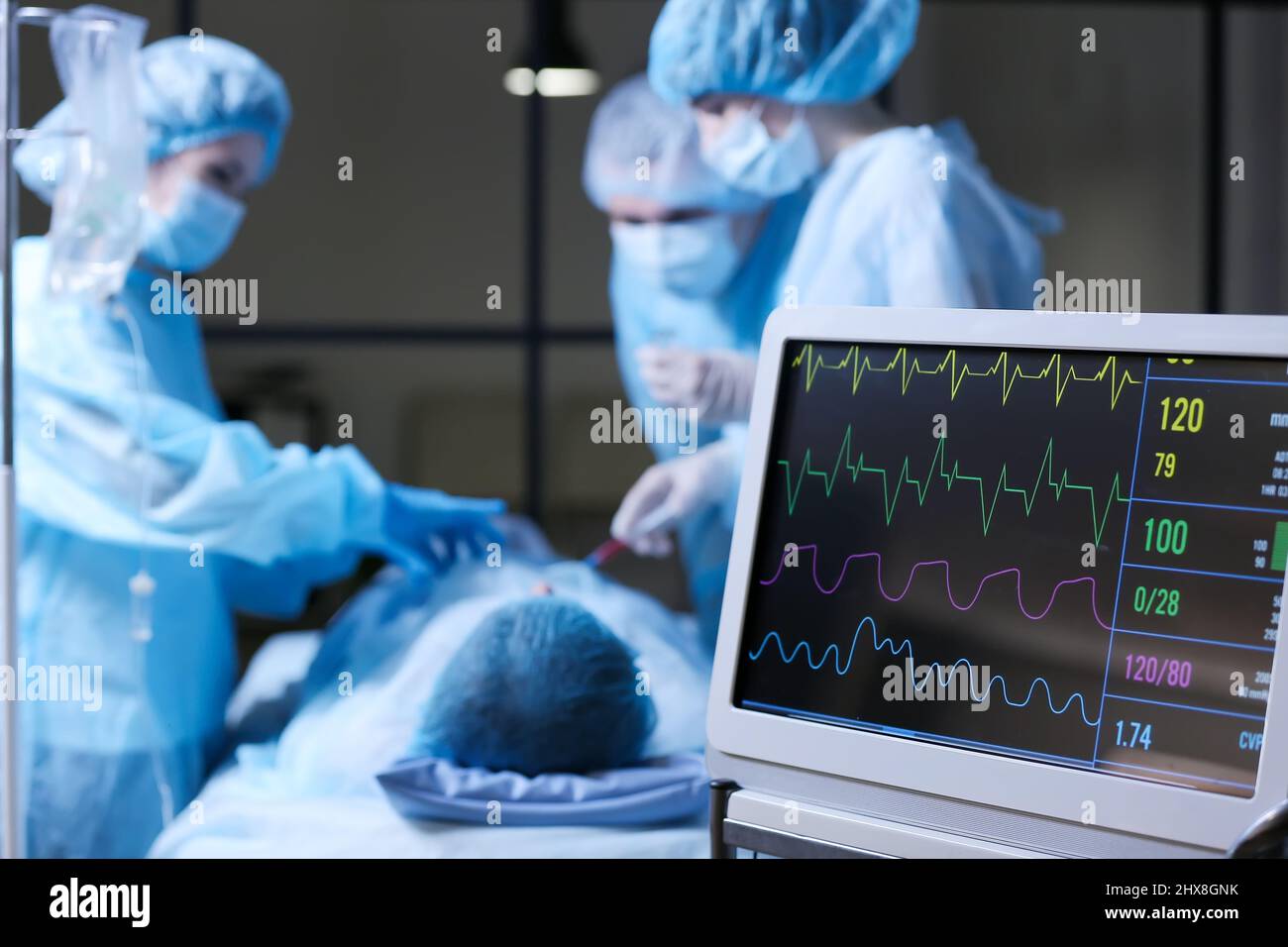 Modern heart rate monitor in operating room Stock Photo - Alamy