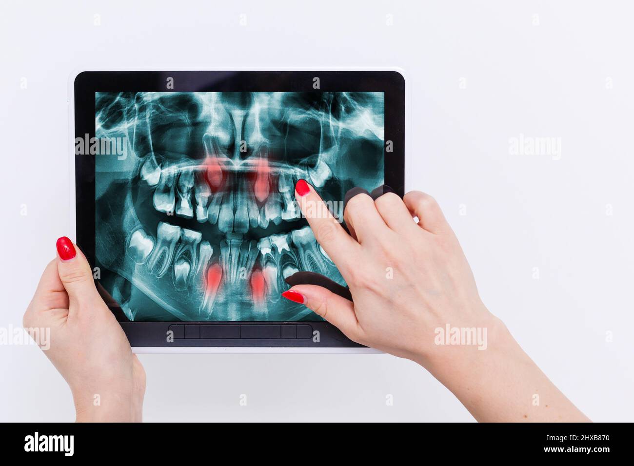 Dentist Office-Digital tablet with a patients x-rays Stock Photo - Alamy