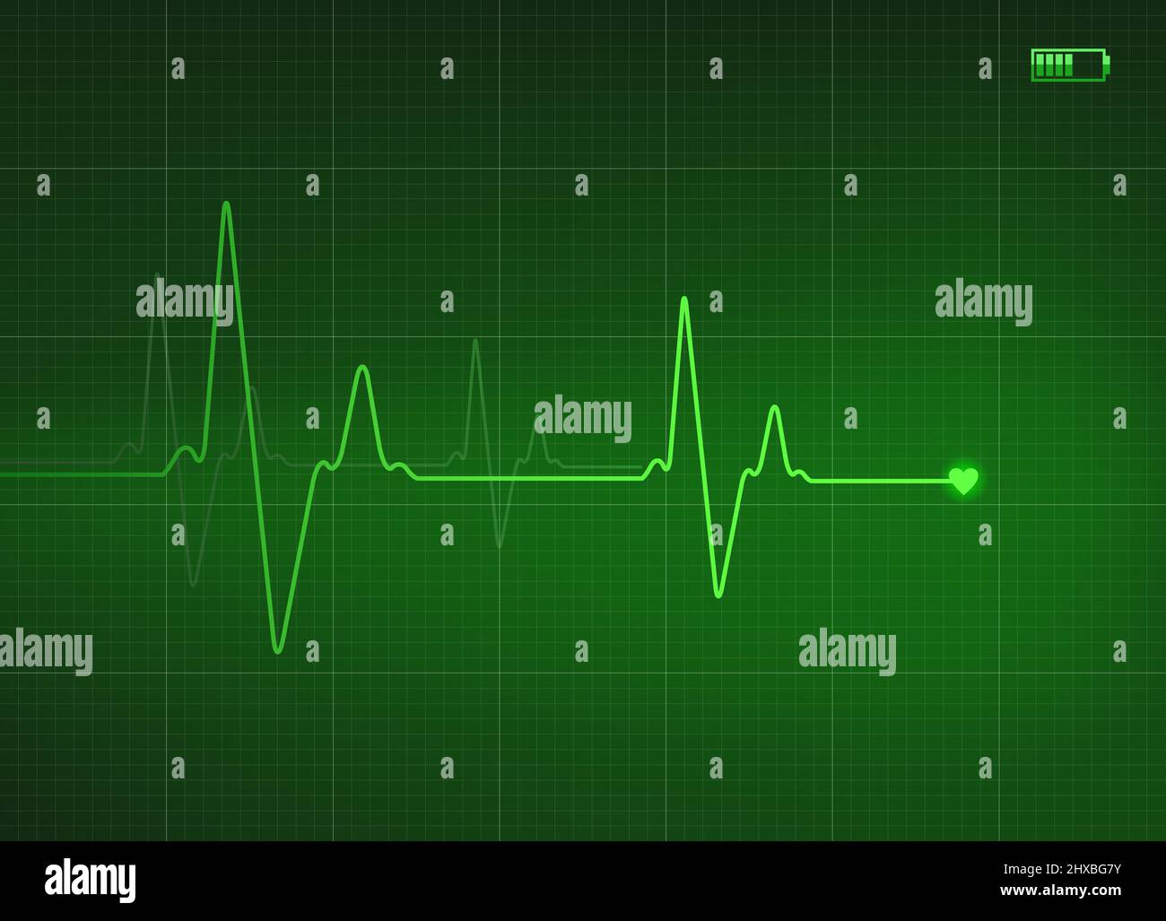 Electrocardiogram illustration in green color with battery icon Stock ...