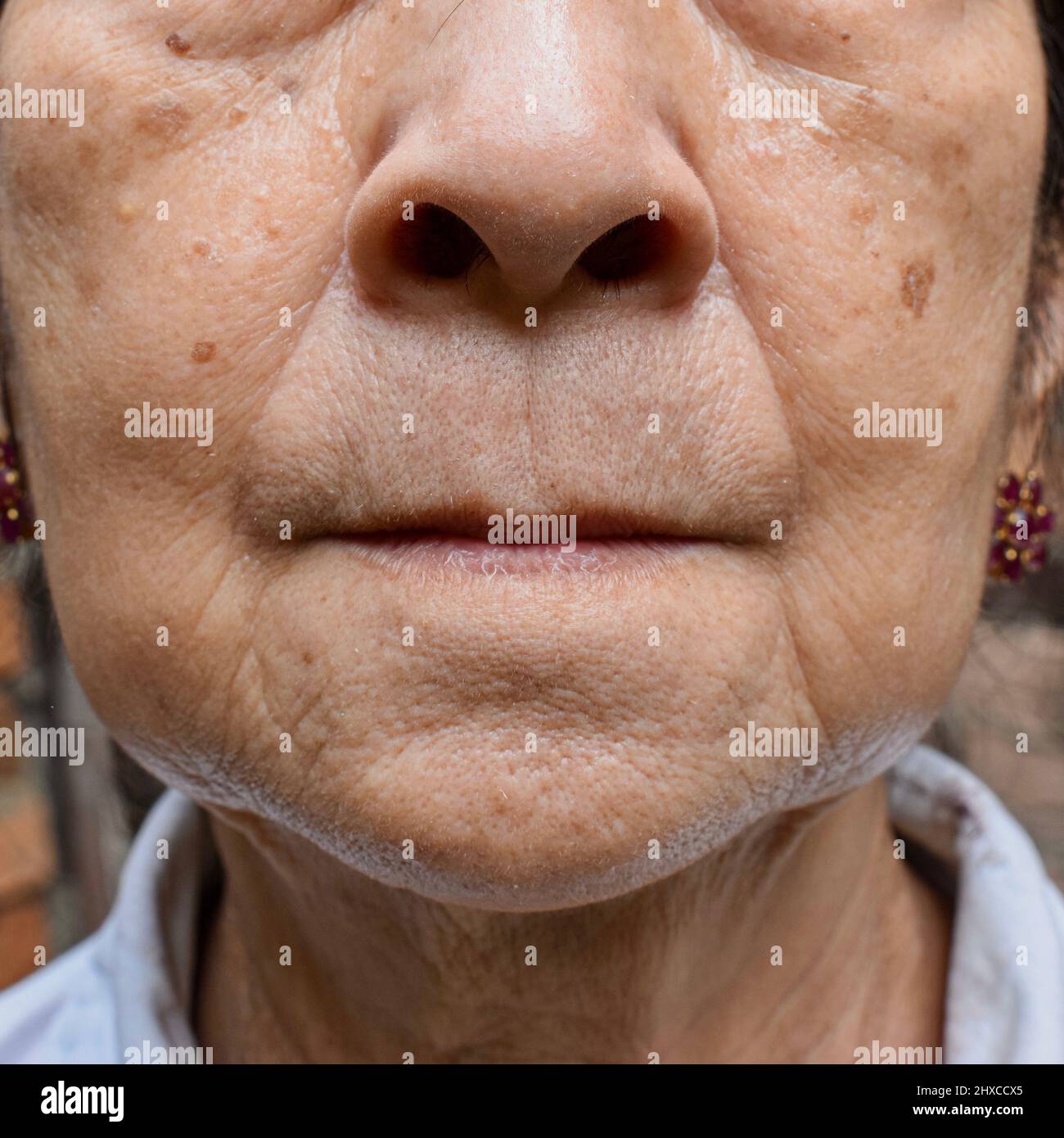 Aging skin folds or skin creases or wrinkles at face of Southeast Asian ...