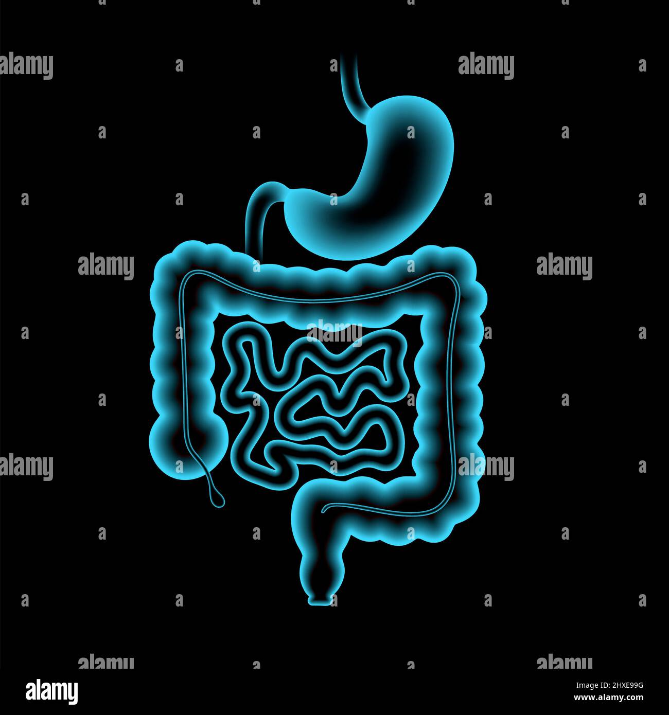 Large intestine endoscopy hi-res stock photography and images - Alamy