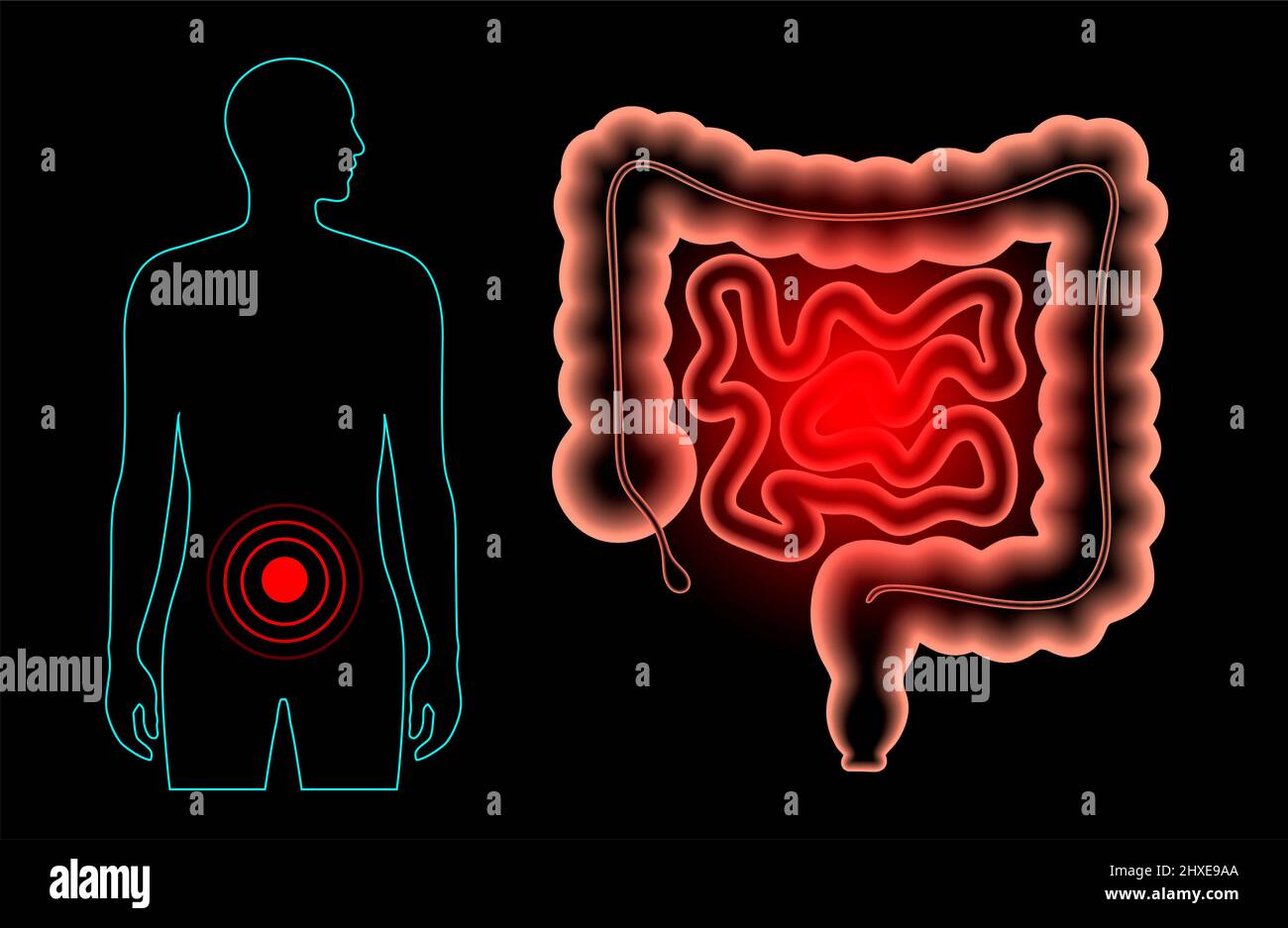 Diagram of the intestinal tract hi-res stock photography and images - Alamy