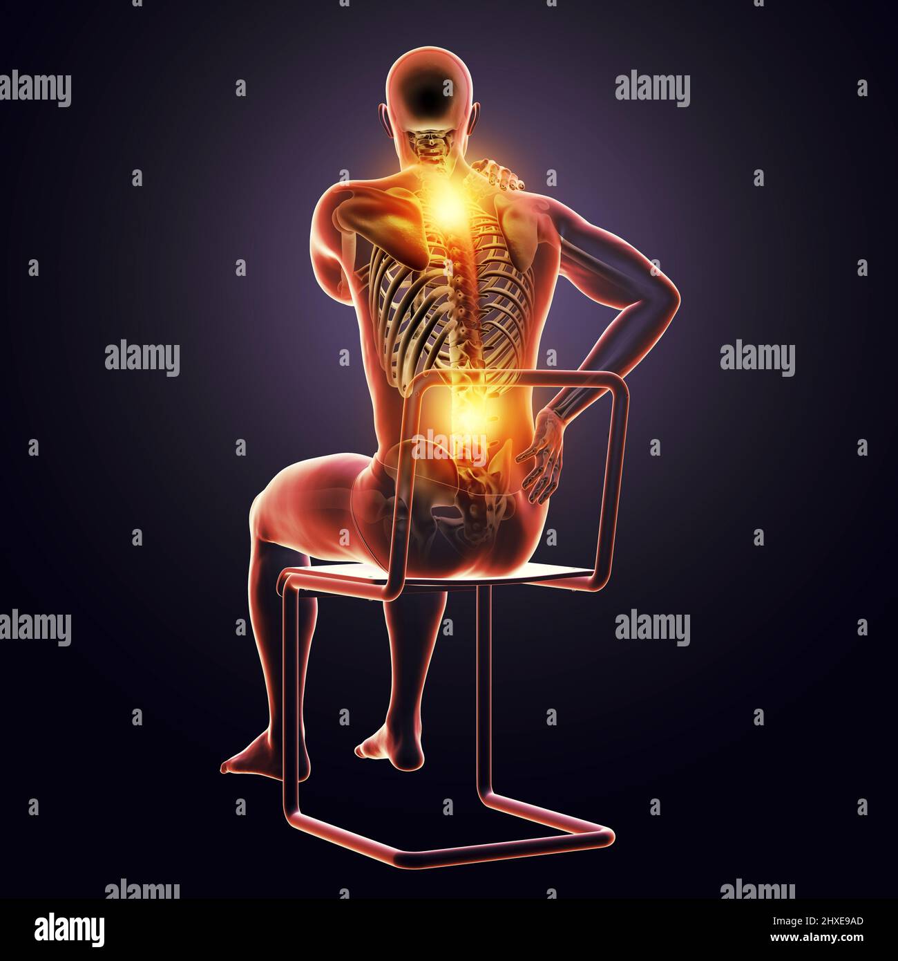 Back pain, conceptual illustration Stock Photo - Alamy