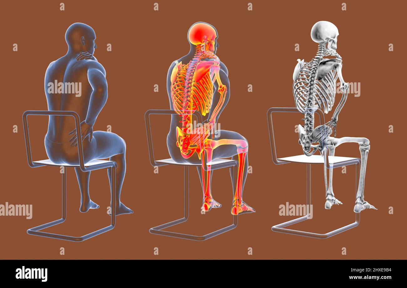 Back pain, conceptual illustration Stock Photo - Alamy