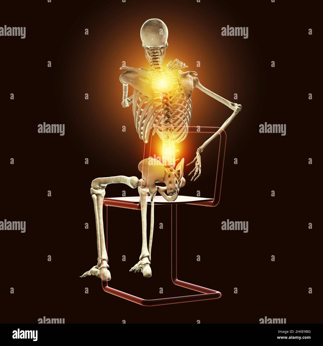 Back pain, conceptual illustration Stock Photo - Alamy