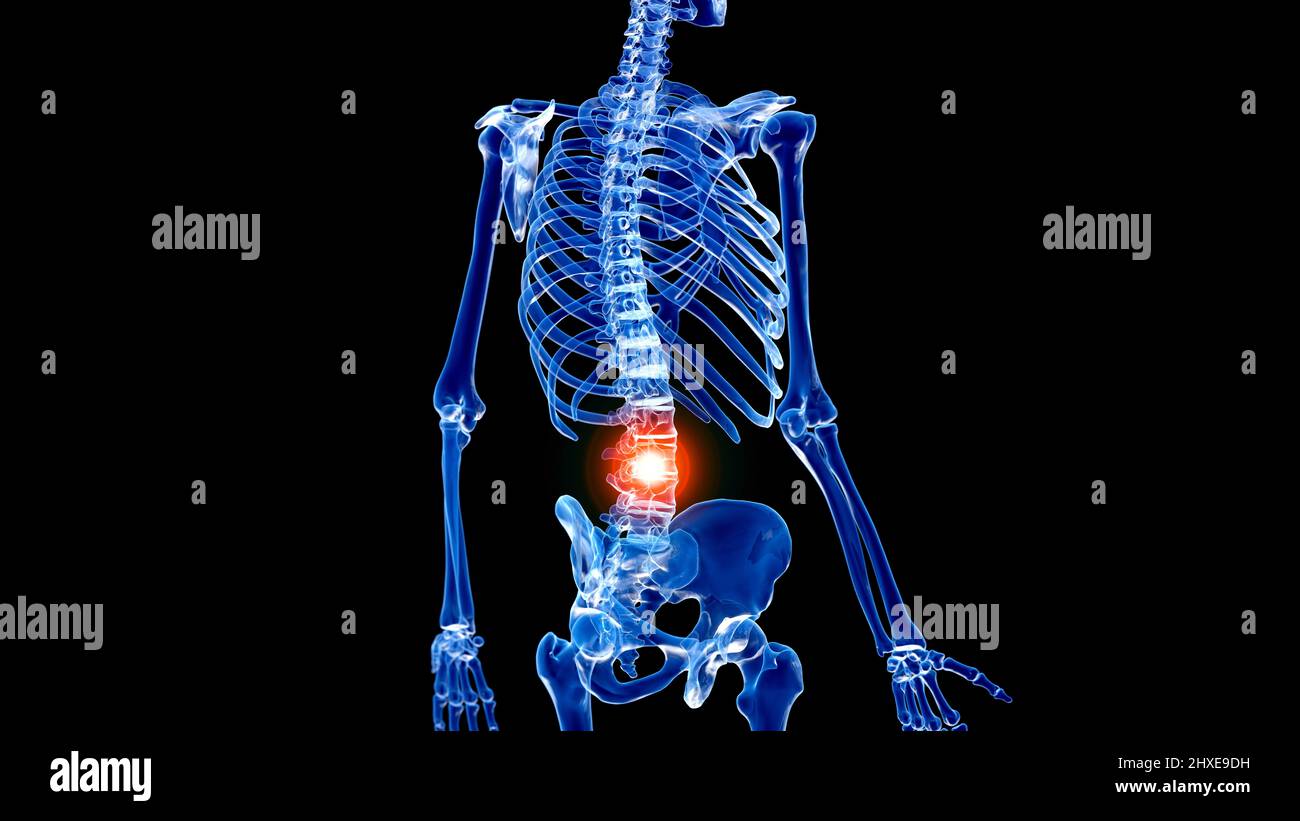 Painful back, illustration Stock Photo - Alamy