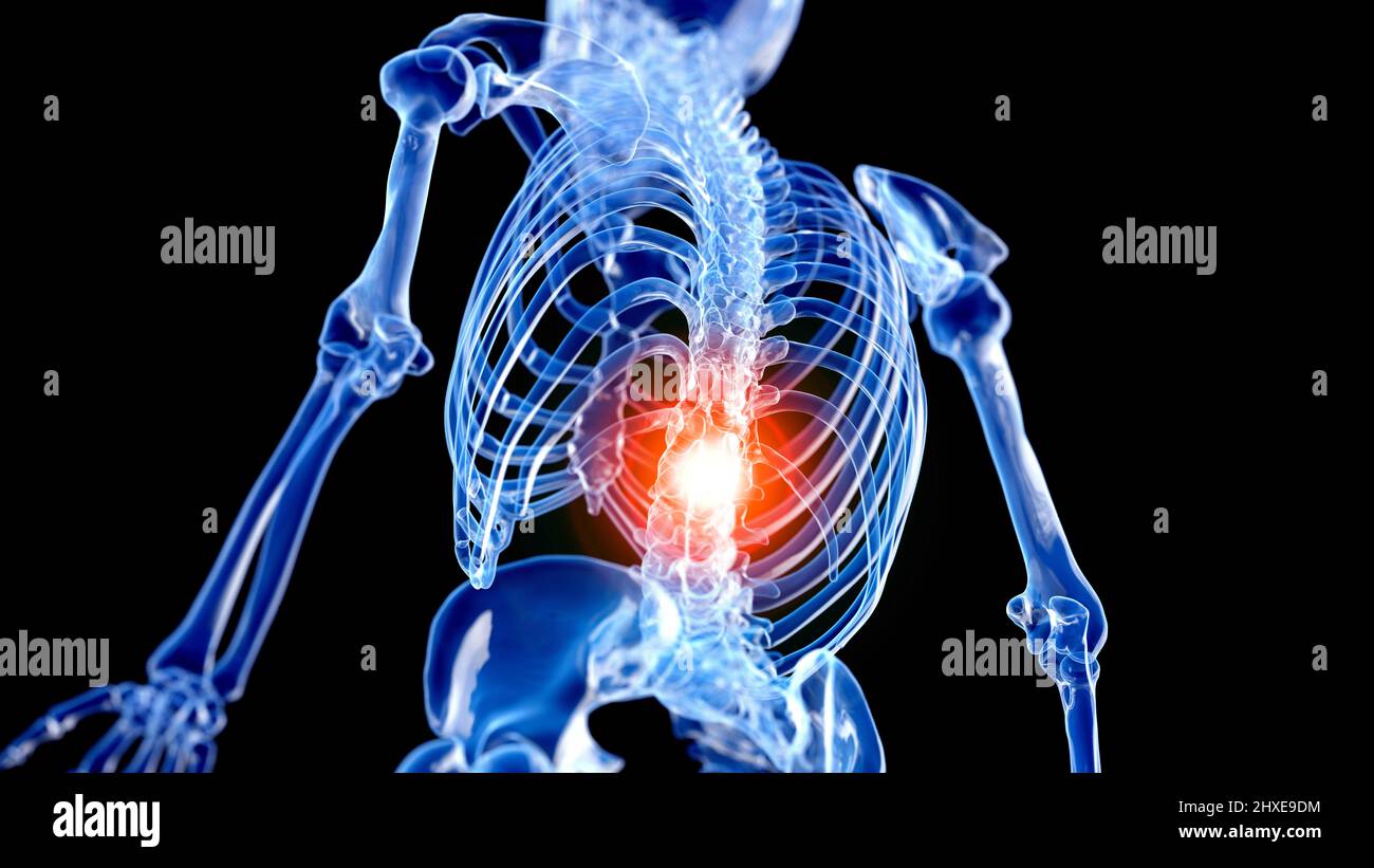 Painful back, illustration Stock Photo - Alamy