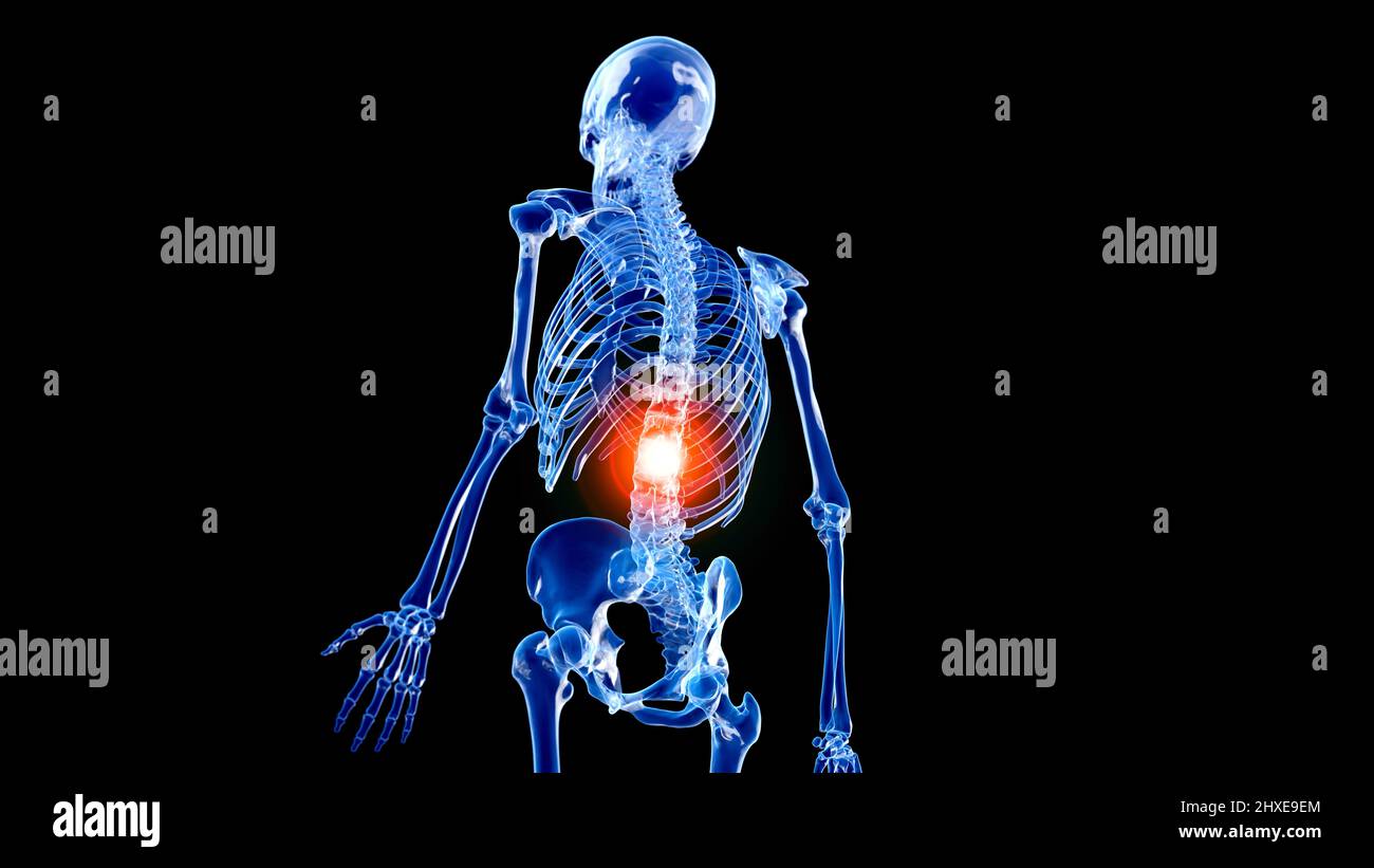 Painful back, illustration Stock Photo - Alamy