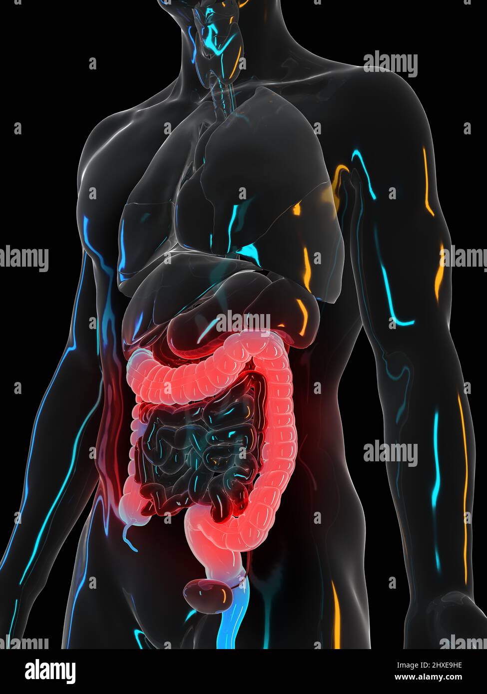 Painful colon, illustration Stock Photo - Alamy