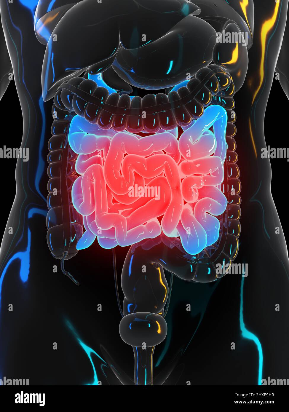 Painful small intestine, illustration Stock Photo - Alamy