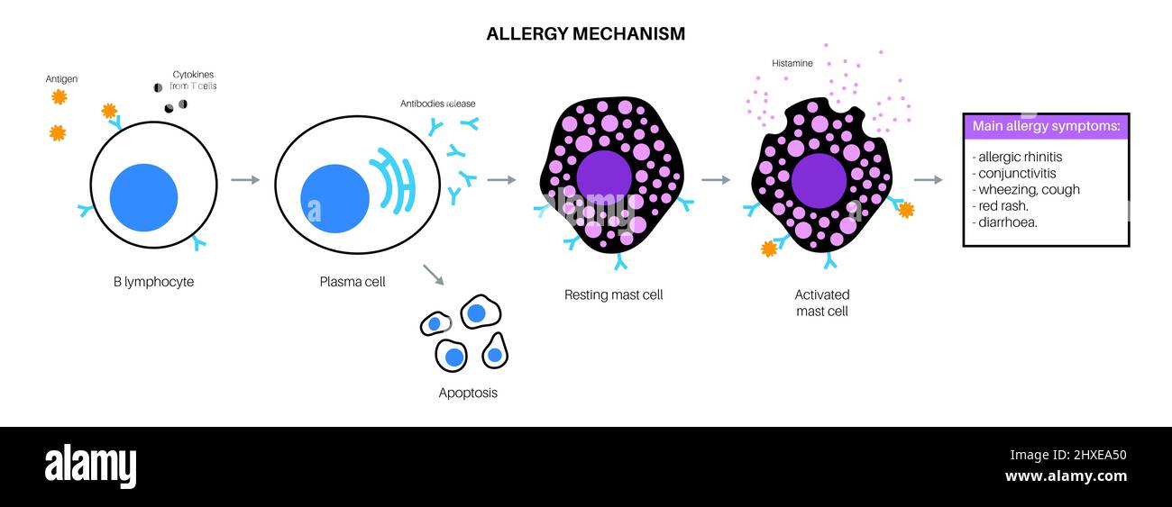 Allergy mechanism, illustration Stock Photo - Alamy