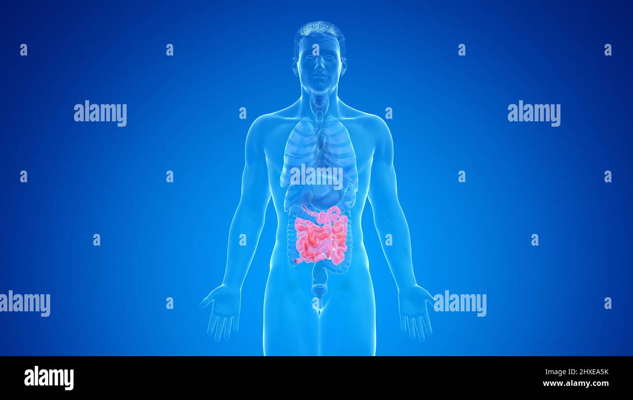 Small bowel obstruction hi-res stock photography and images - Alamy