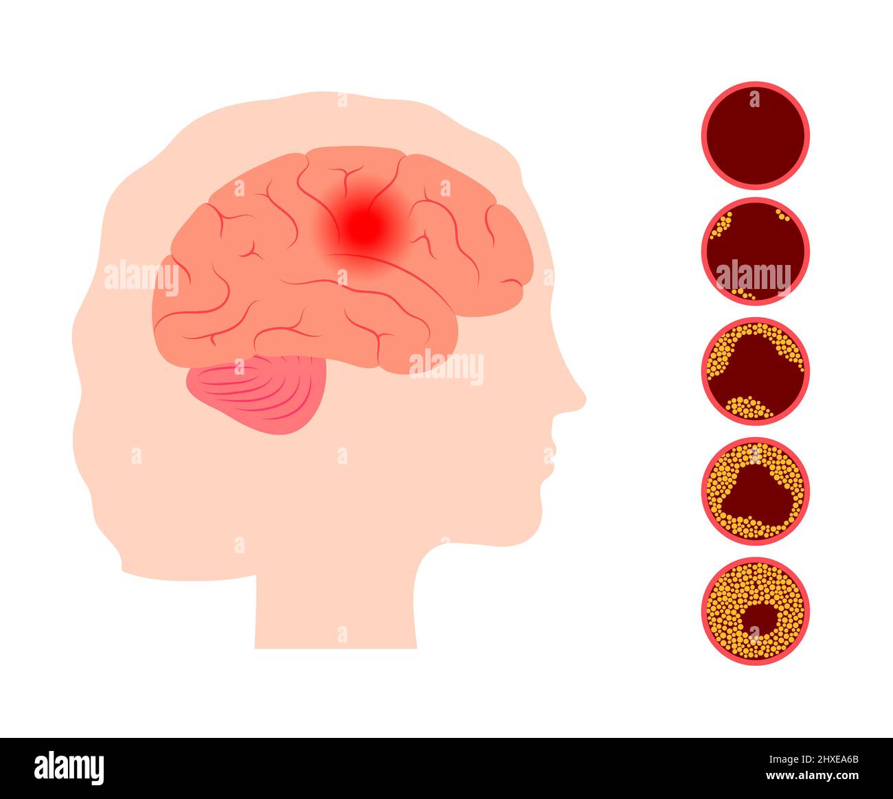 Illustration woman head brain Cut Out Stock Images & Pictures - Alamy