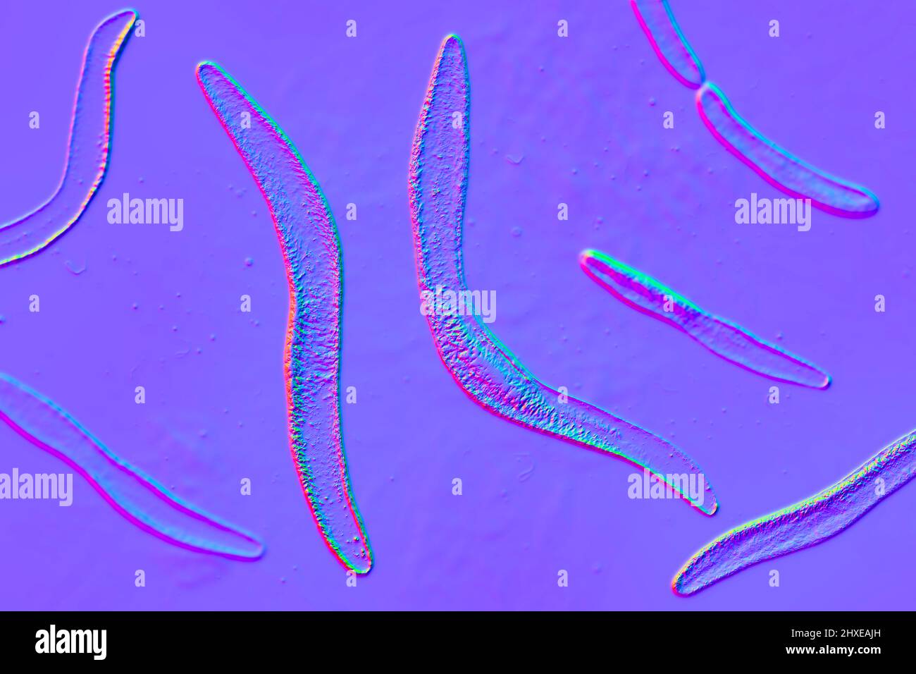 Fusobacterium necrophorum bacteria hi-res stock photography and images ...