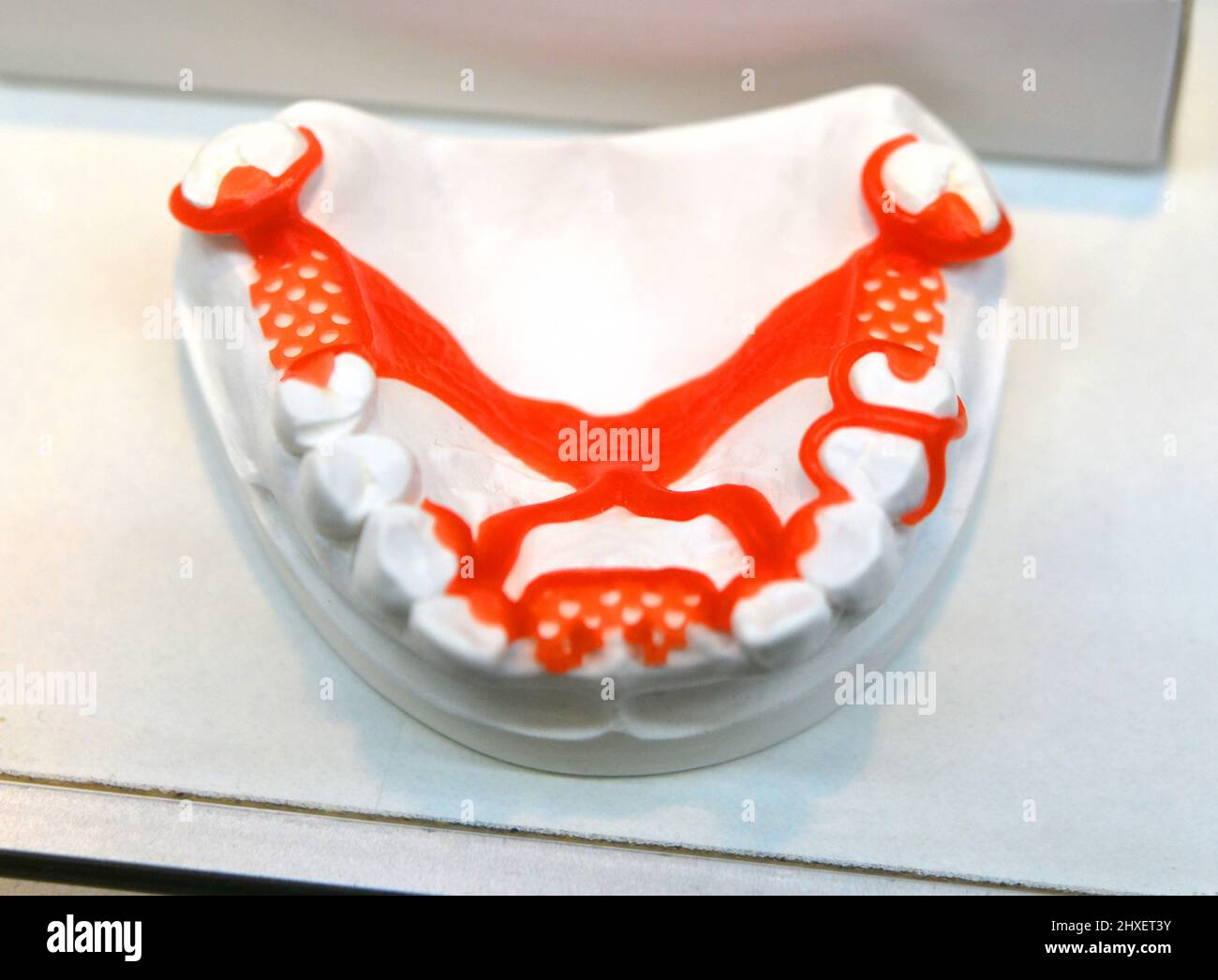 Implantation implantat hi-res stock photography and images - Alamy