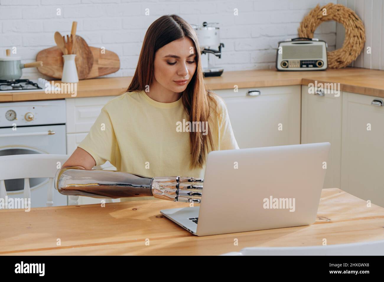 Modern prosthesis works bionic hand hi-res stock photography and images ...