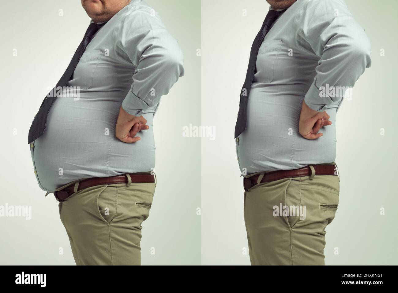 Belly fat before after hi-res stock photography and images - Alamy