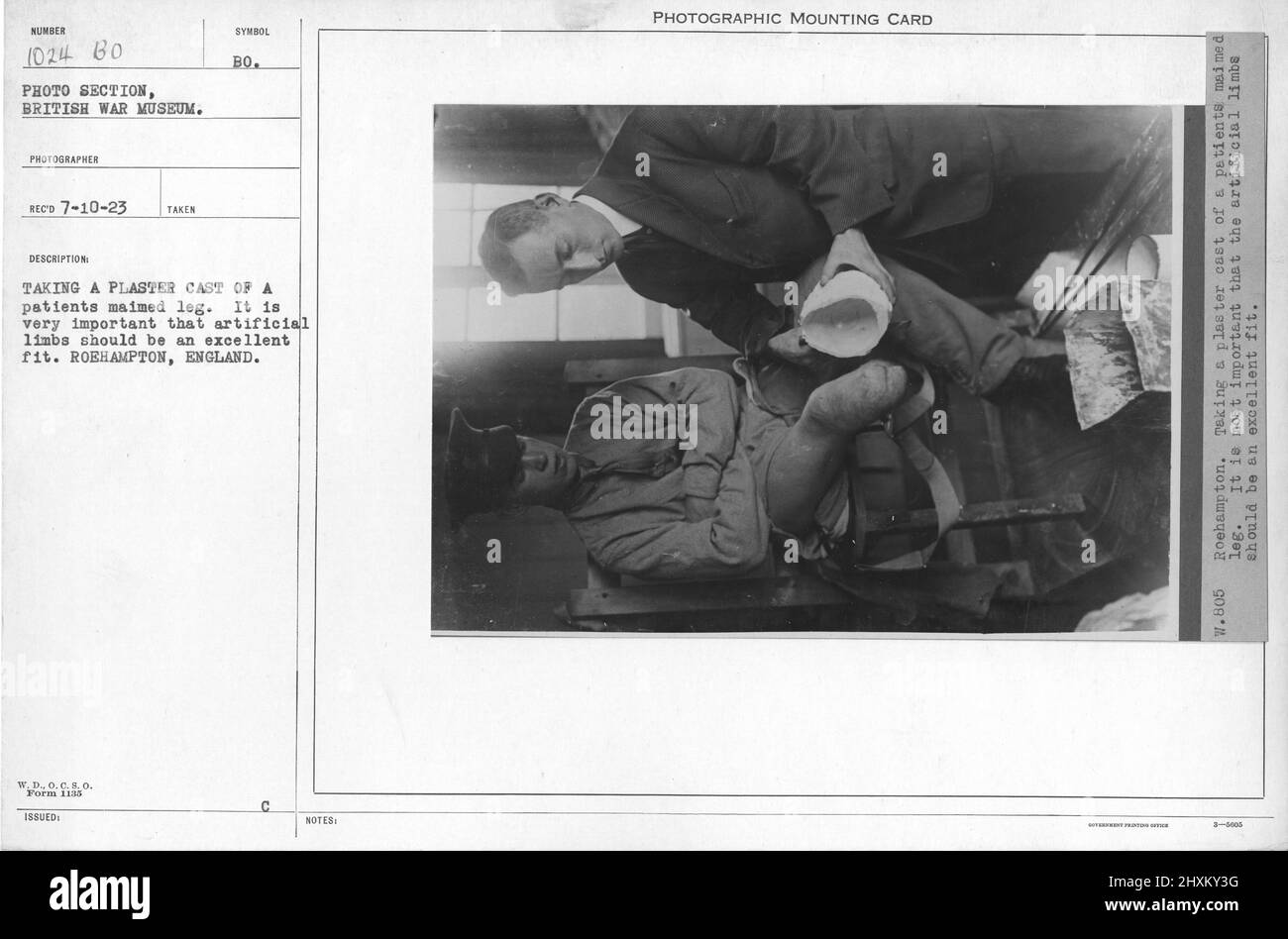 Taking a plaster cast of a patient maimed leg. It is very important ...