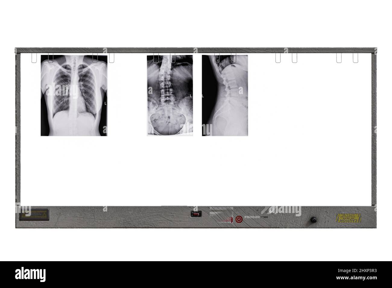 x-ray film viewer isolated on white background 3d illustration Stock ...